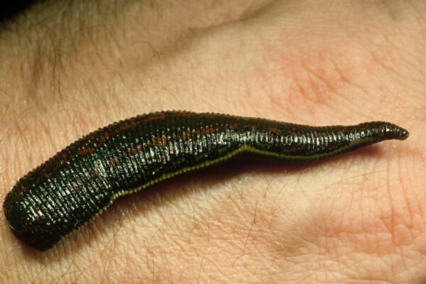 Pijawki naturalną terapią – Ogólnotematyczny Blog SaidA